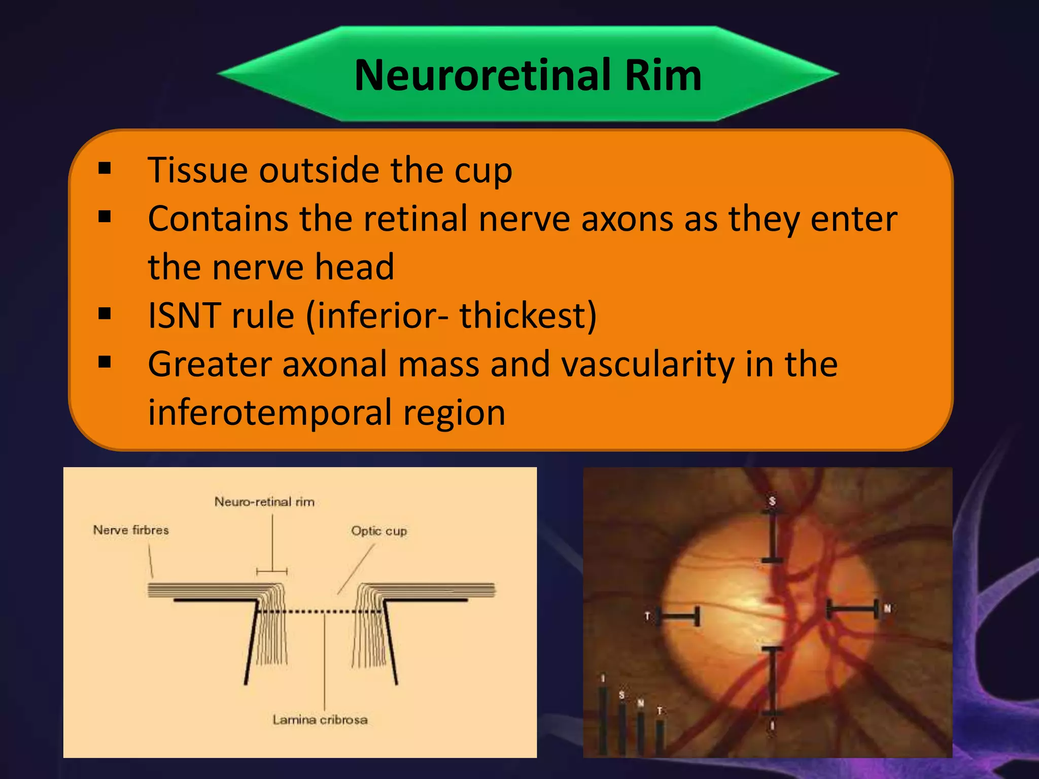 Anatomy of Optic Nerve | PPTX