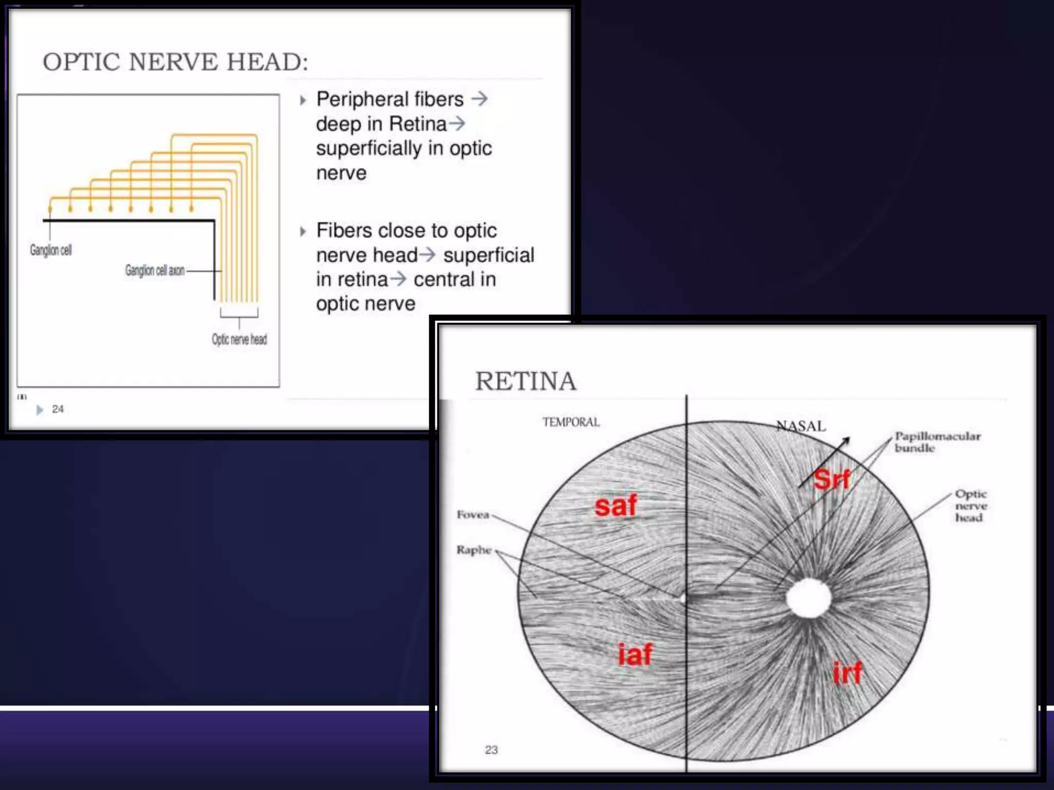 Anatomy of Optic Nerve | PPTX