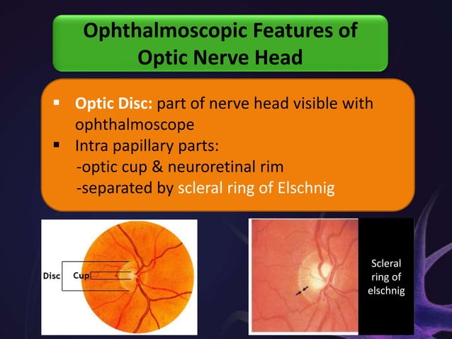 Anatomy of Optic Nerve | PPTX | Eye and Vision Conditions | Diseases ...
