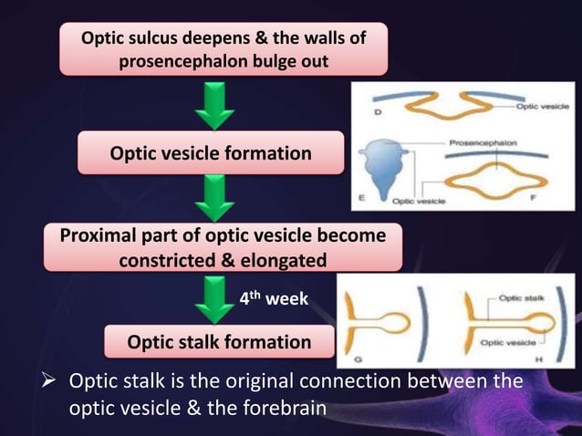 Anatomy of Optic Nerve | PPTX | Eye and Vision Conditions | Diseases ...