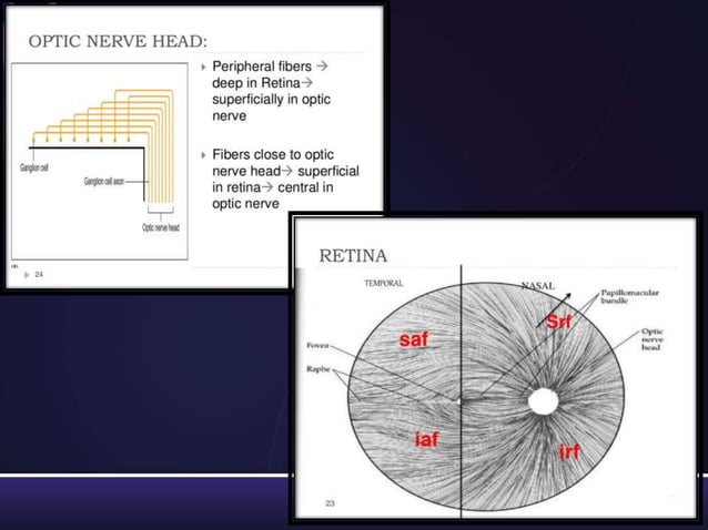 Anatomy of Optic Nerve | PPTX | Eye and Vision Conditions | Diseases ...