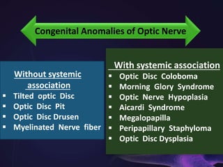 Anatomy of Optic Nerve | PPTX