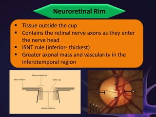 Anatomy of Optic Nerve | PPT