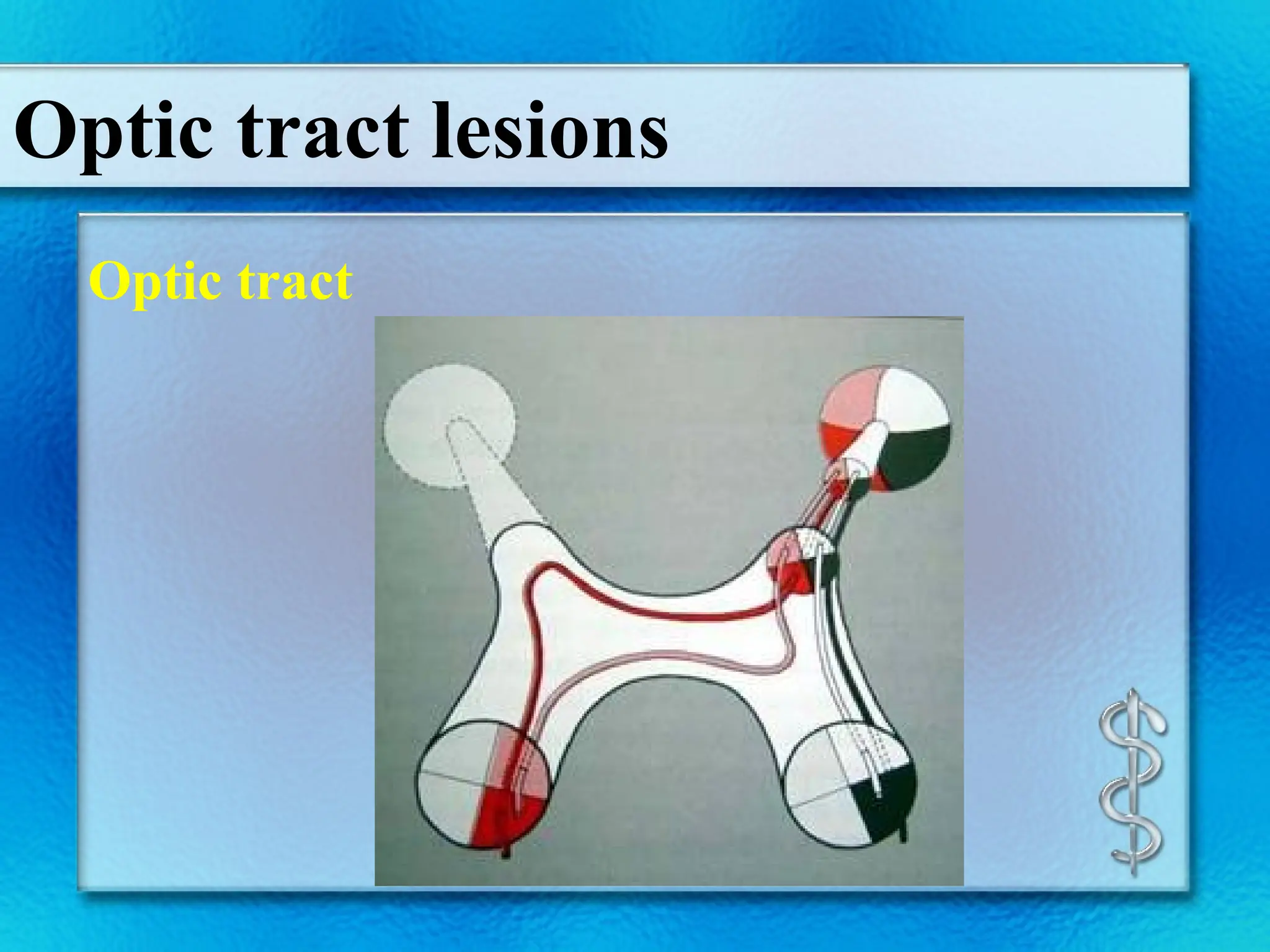 OPtic nerve OK Neuro-ophthalmology for MBBs | PPT