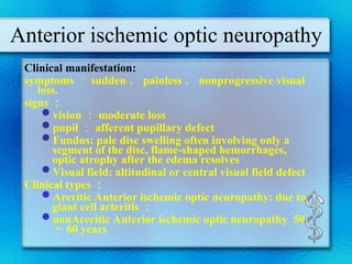 OPtic nerve OK Neuro-ophthalmology for MBBs | PPT