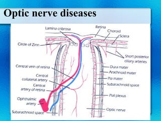 OPtic nerve OK Neuro-ophthalmology for MBBs | PPT