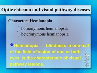 OPtic nerve OK Neuro-ophthalmology for MBBs | PPT