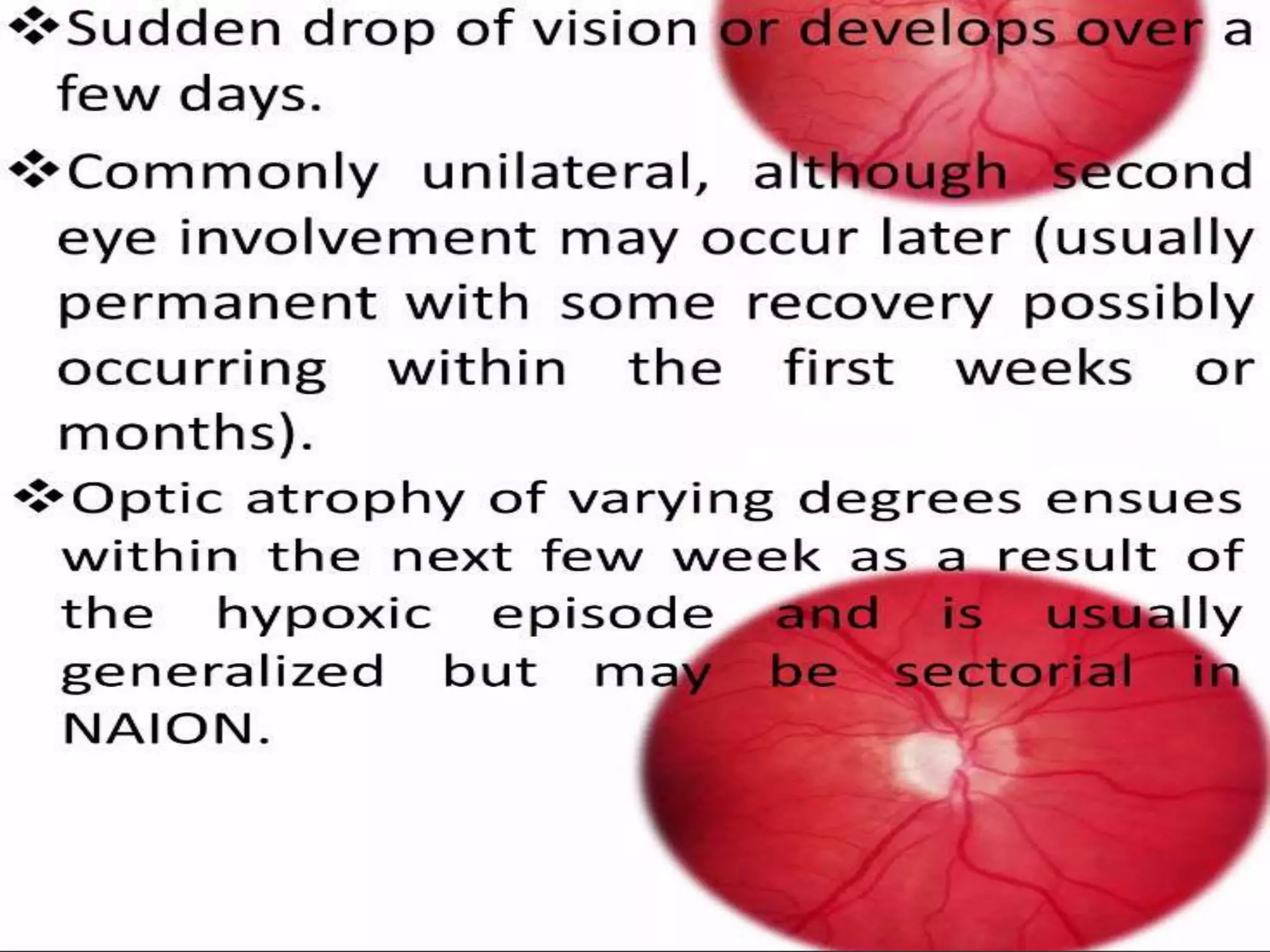Optic nerve optic atrophy Clinical Round | PPT