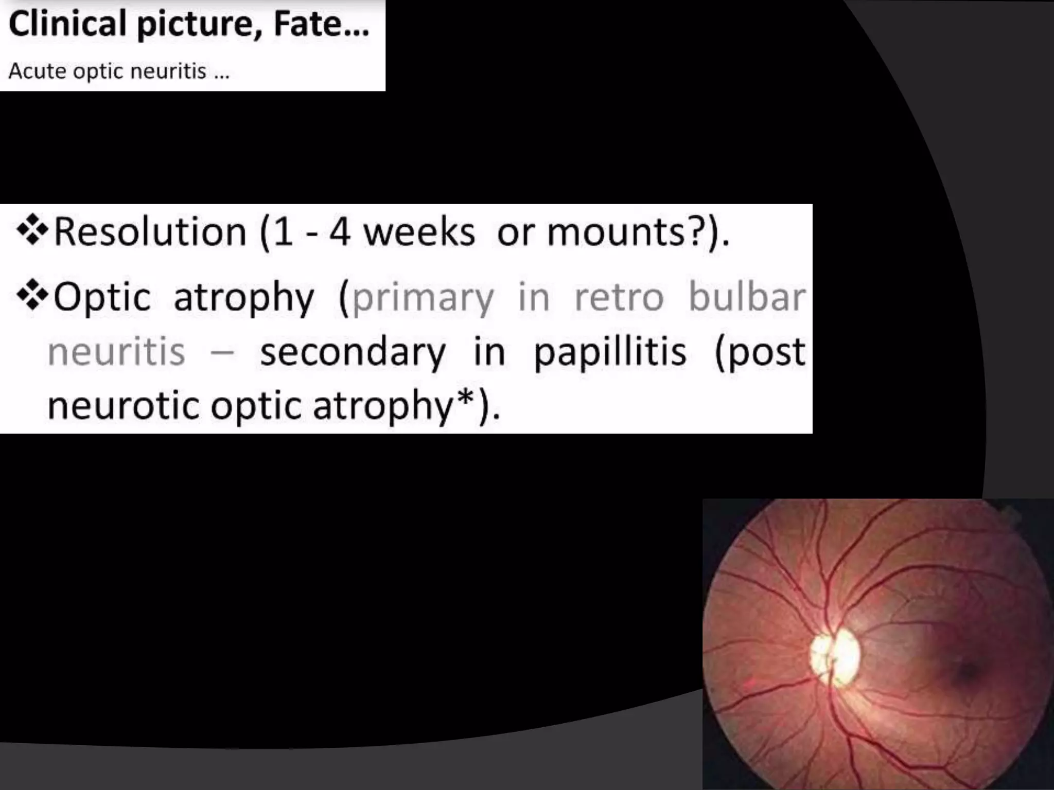 Optic nerve optic neuritis Clinical round | PPTX