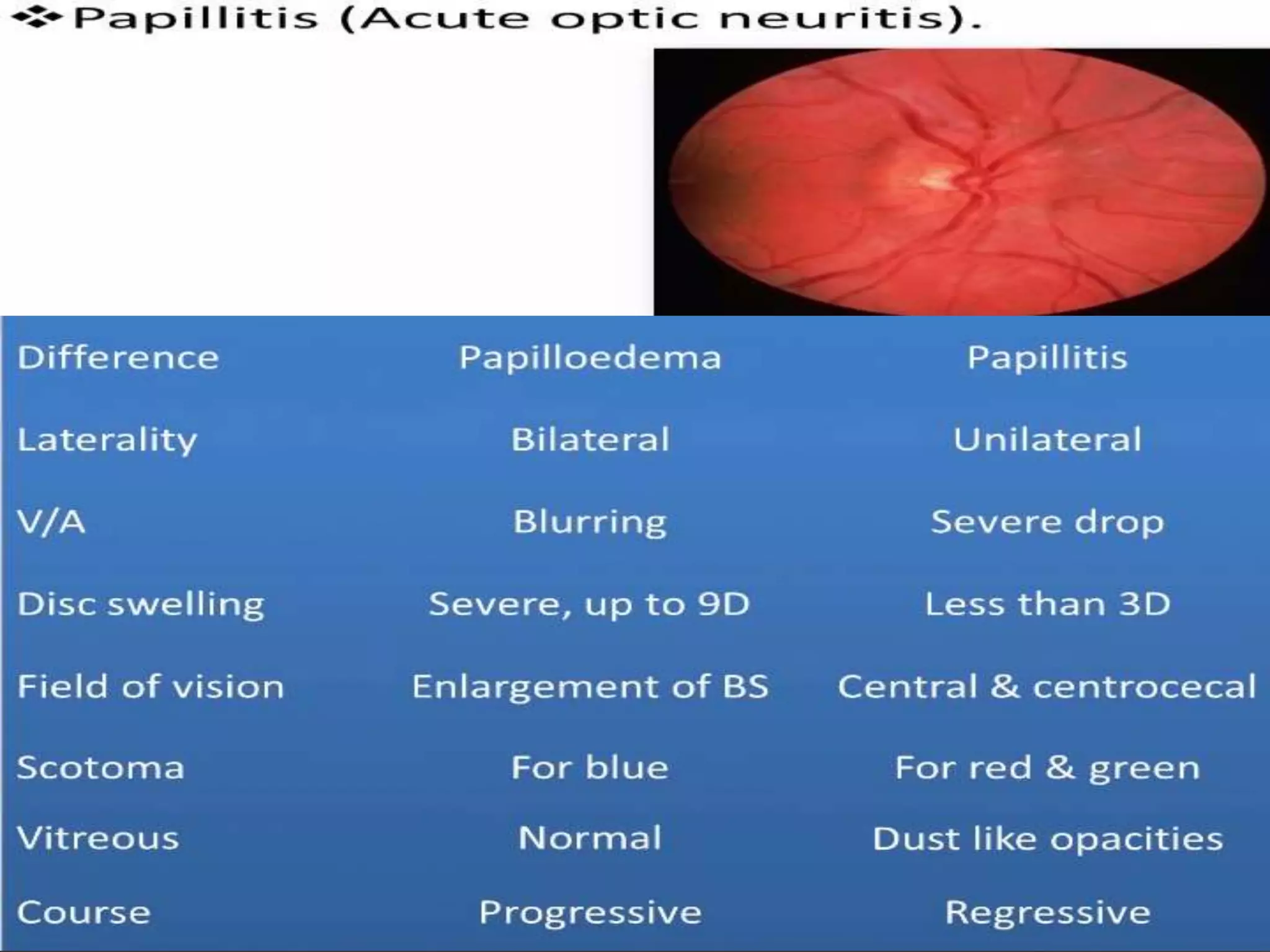 Optic nerve pappiloedema clinical round | PPT