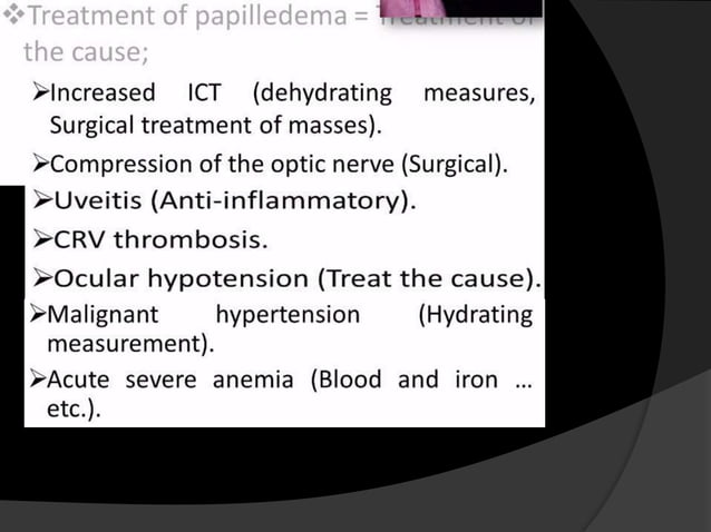 Optic nerve pappiloedema clinical round | PPT