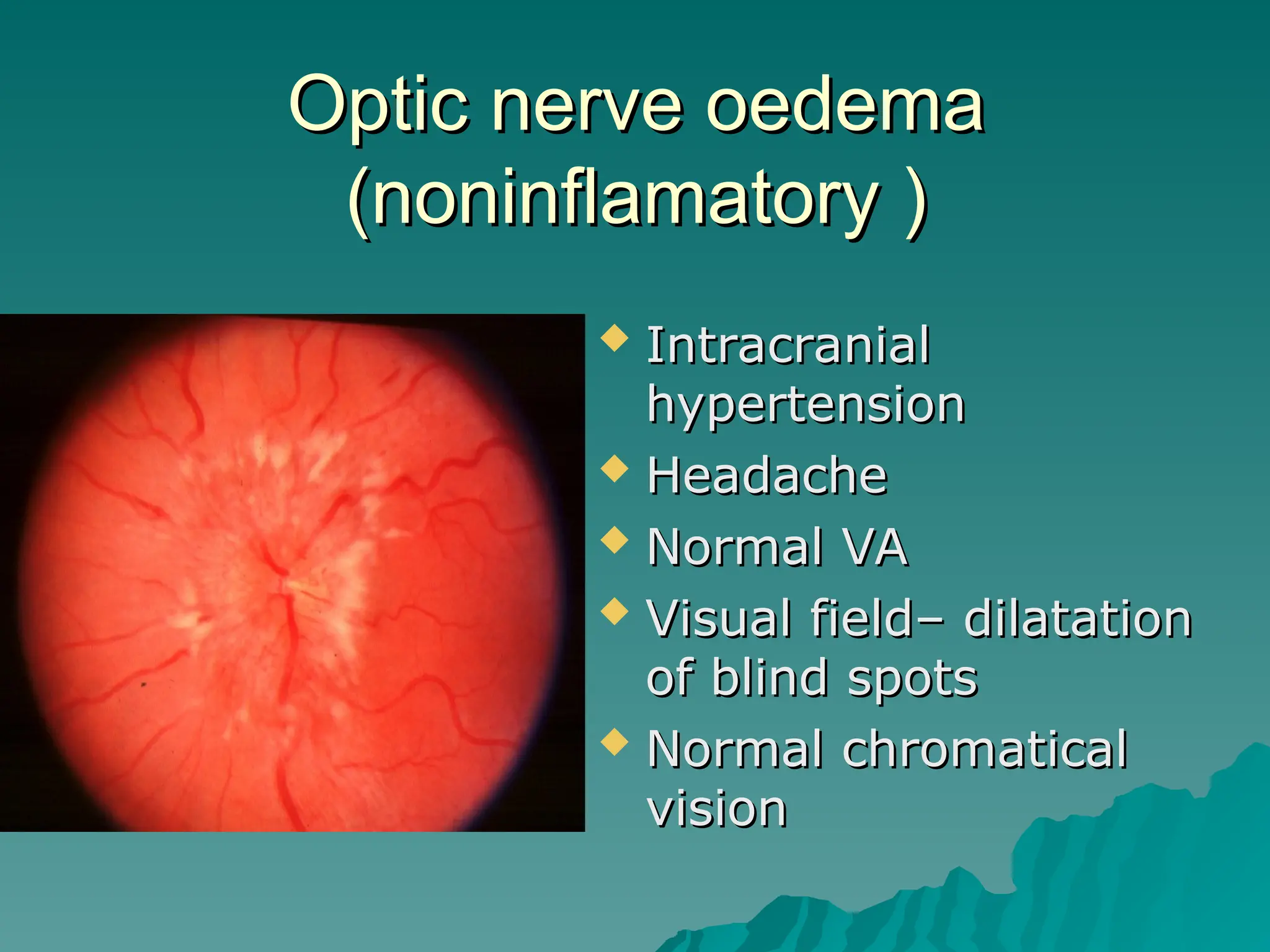 Optic nerve pathology in ophthalmology.ppt
