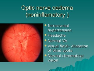 Optic nerve pathology in ophthalmology.ppt