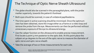 Optic Nerve Sheath Diameter (ONSD) Measurement for Intracranial ...