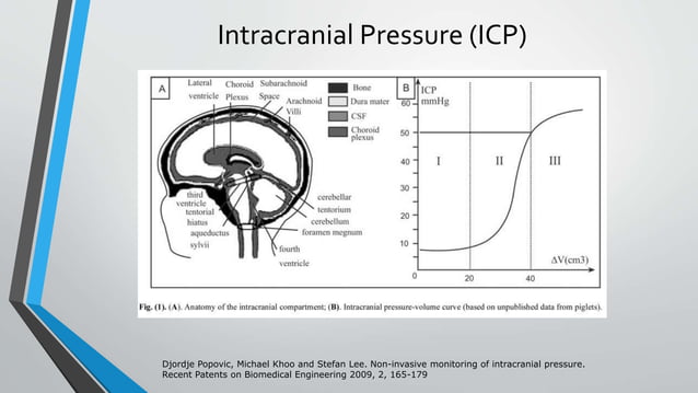 Optic Nerve Sheath Diameter (ONSD) Measurement for Intracranial ...