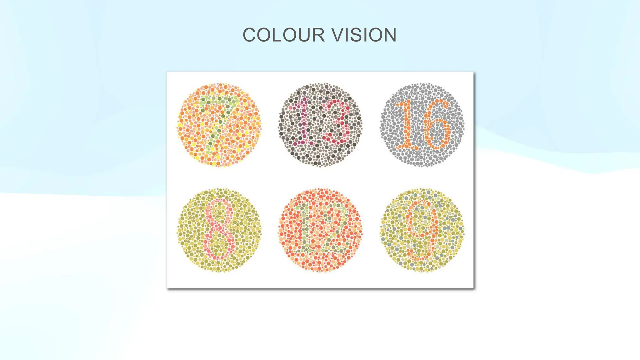 Optic nerve The nerve of sight ppt for Mch | PPT