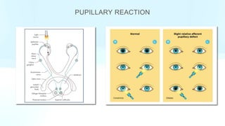 Optic nerve The nerve of sight ppt for Mch | PPTX