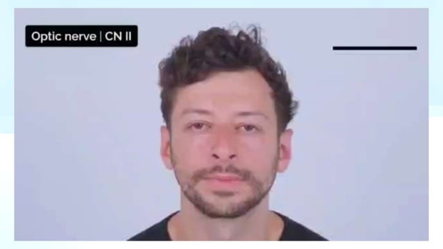 Optic nerve The nerve of sight ppt for Mch | PPT