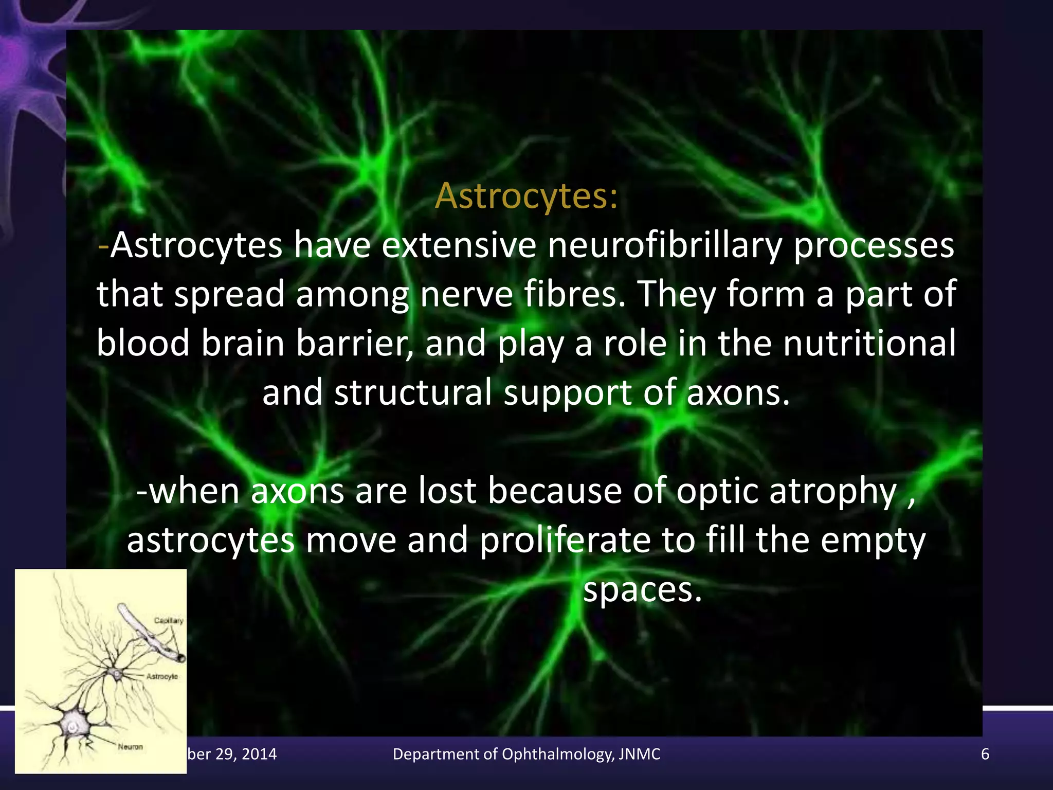 Optic nerve tumors ppt | PPTX