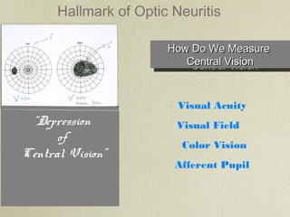 Optic Neuritis Vision