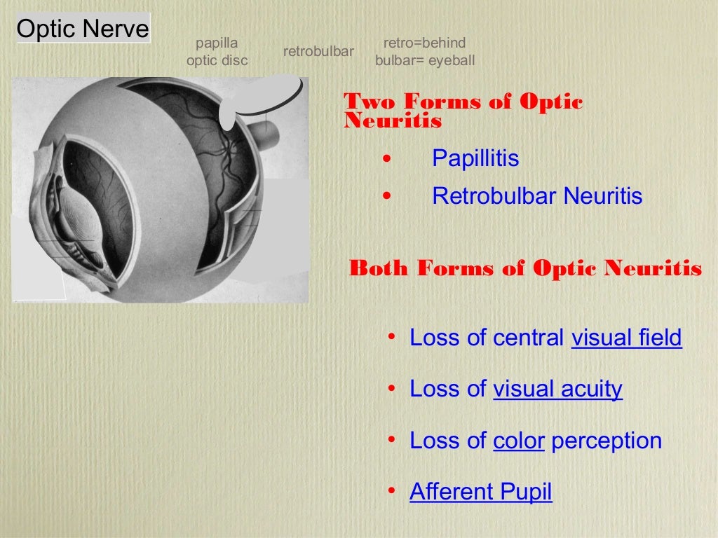 Optic neuritis