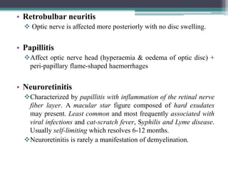 Optic neuritis | PPTX