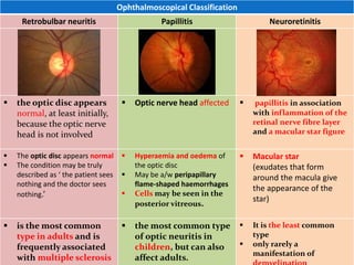 Optic neuritis | PPTX