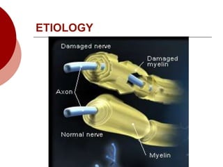 Optic neuritis | PPTX