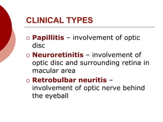 Optic neuritis | PPT