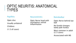 Optic neuritis | PPTX