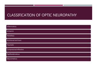 Optic neuritis | PPTX
