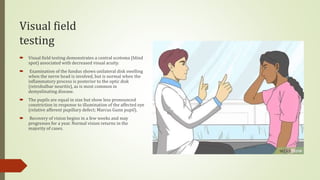 Optic Neuritis .pptx