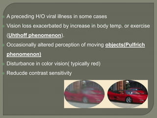 Optic Neuritis.pptx