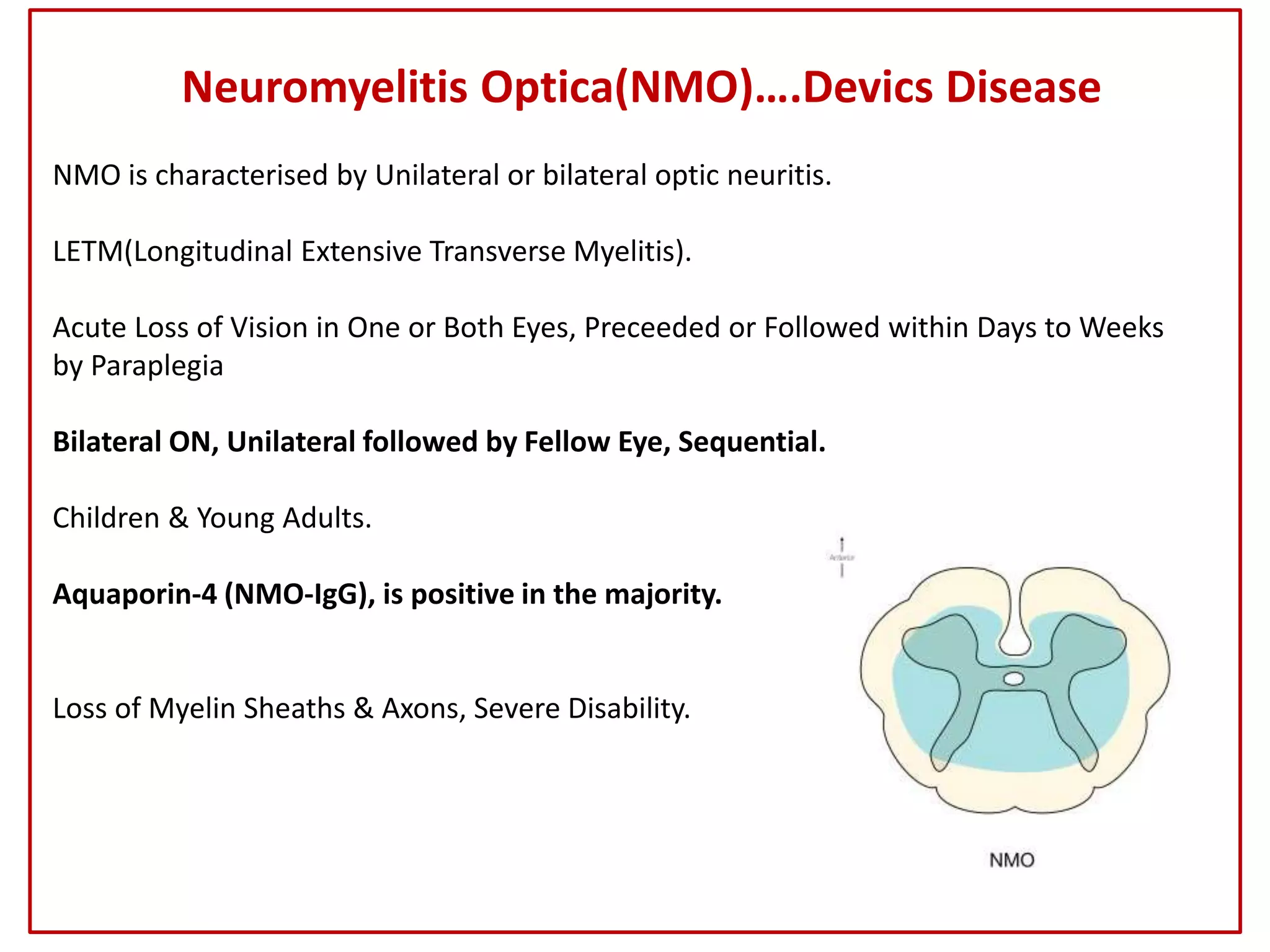 Optic neuritis.Neuroophthalmology, Teaching Slides, Dr M D Mohire ...
