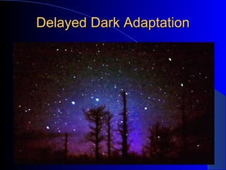 Optic neuritis treatment trial | PPT