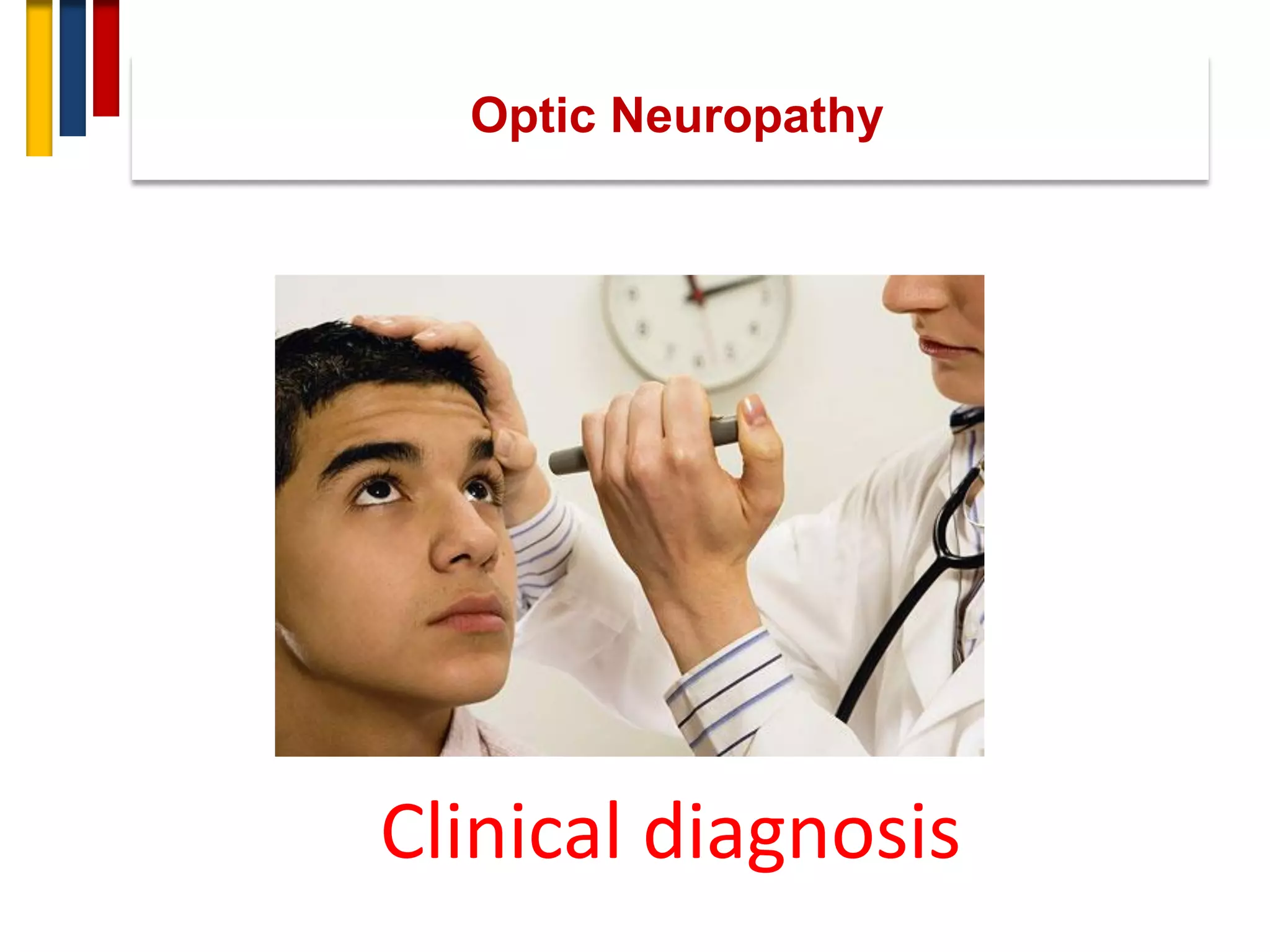 Optic neuropathy | PDF