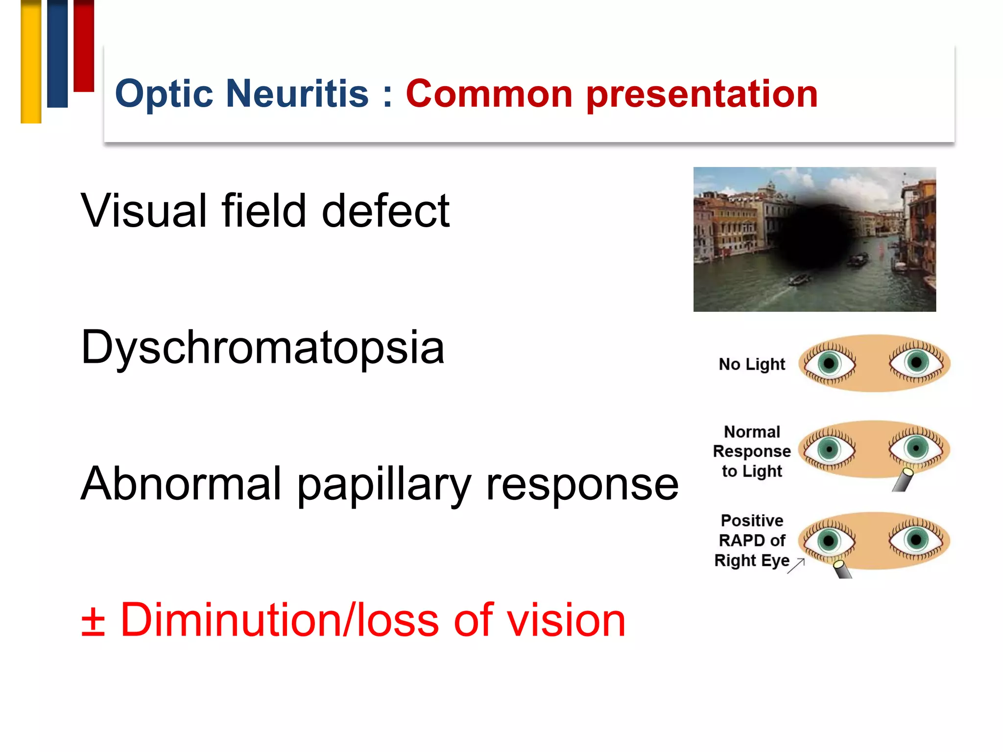 Optic neuropathy | PDF