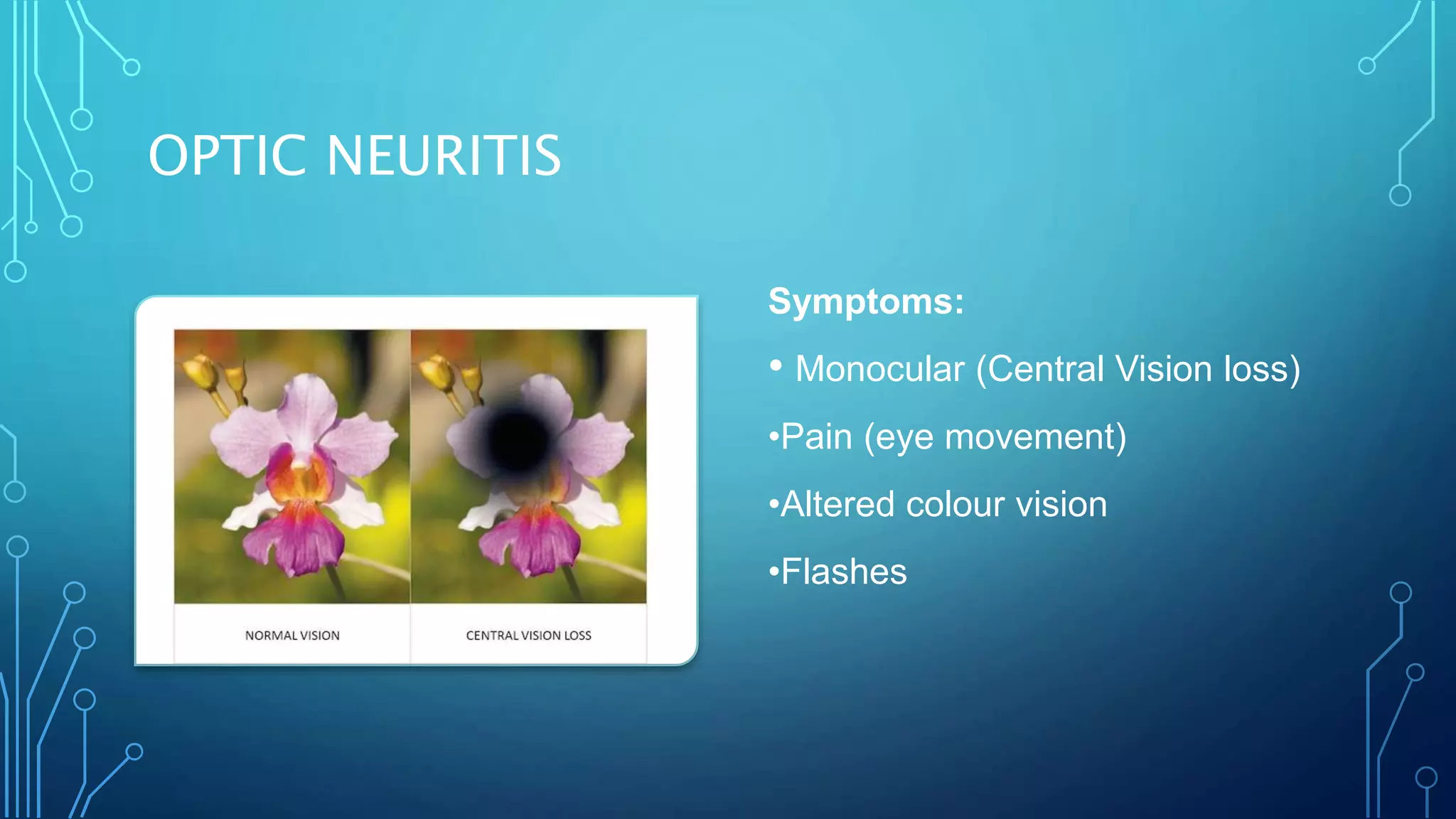 Optic Neuropathy (overview).pptx