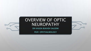 Optic Neuropathy (overview).pptx
