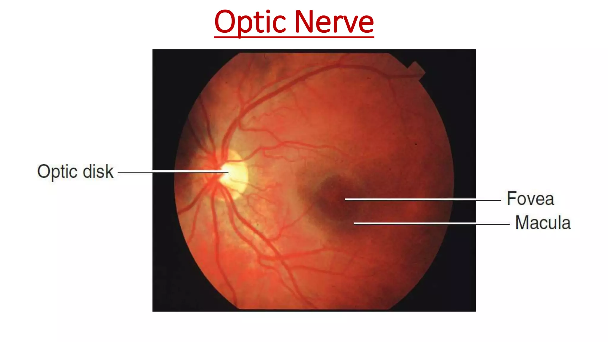 optic pathway and its lesions (2).pptx
