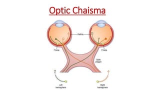 optic pathway and its lesions (2).pptx