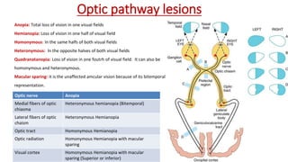 optic pathway and its lesions (2).pptx