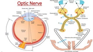optic pathway and its lesions (2).pptx