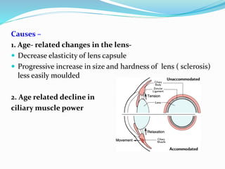 optic refraction 5.pptx