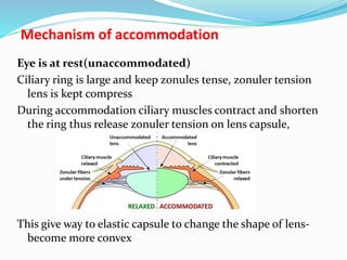 optic refraction 5.pptx