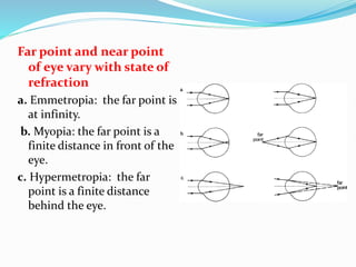 optic refraction 5.pptx