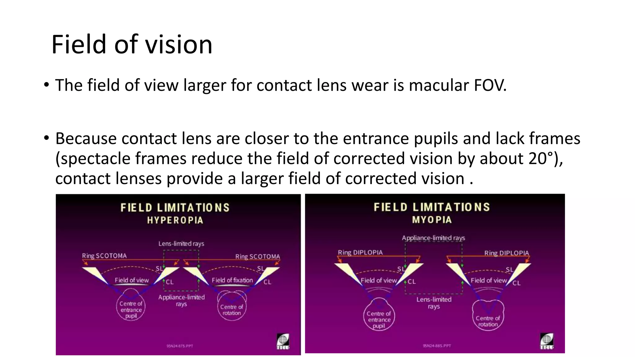 Optics and design of soft contact lens.pptx