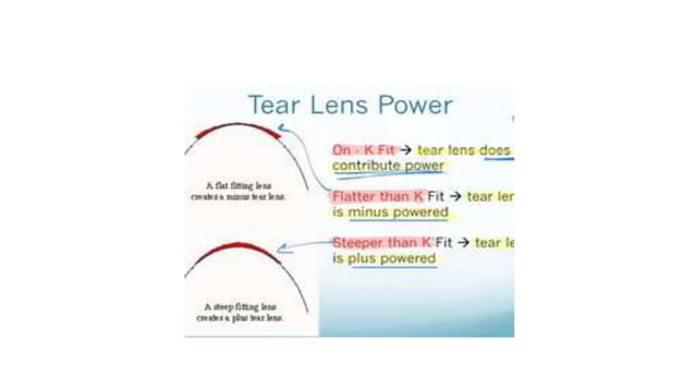 Optics and design of soft contact lens.pptx