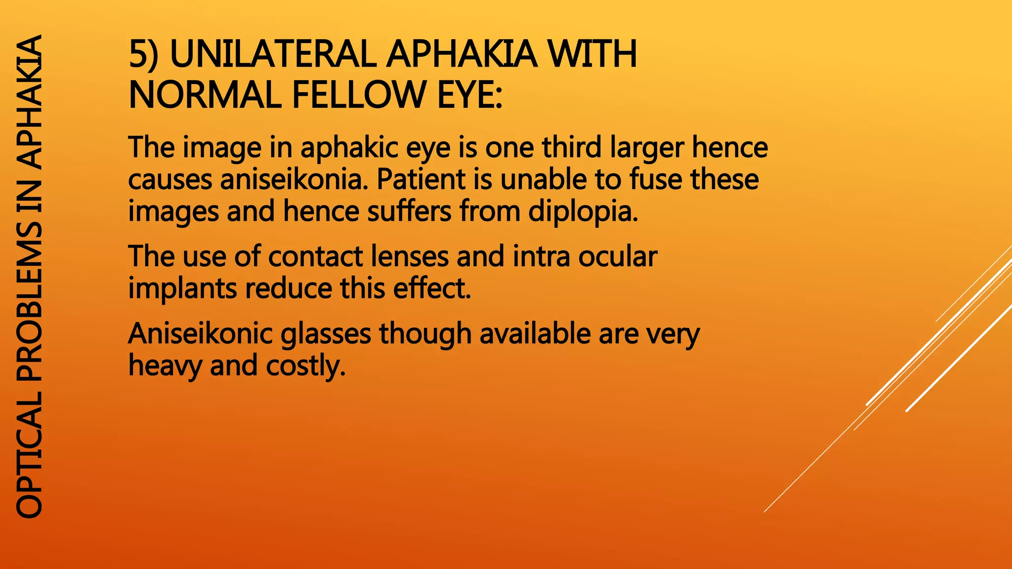 Optics of ametropia | PPTX