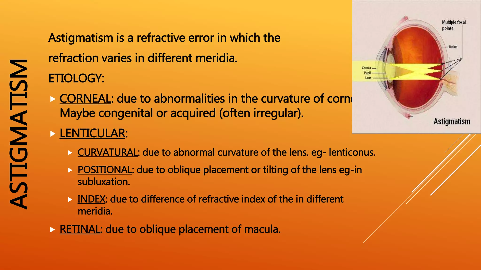 Optics of ametropia | PPTX